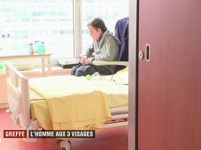 Double greffé du visage : première mondiale | INA