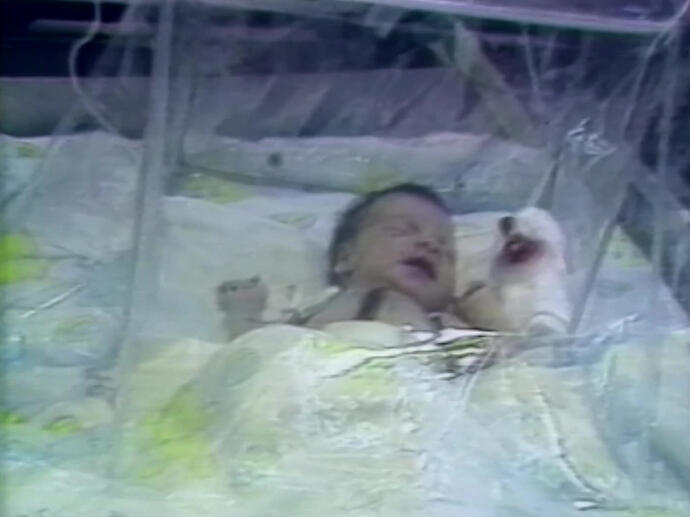 Etats Unis : un bébé vit depuis 5 jours avec un coeur de babouin | INA