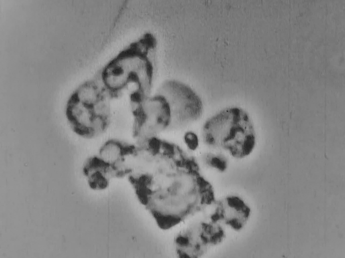 Cellules humaines vues au microscope | INA