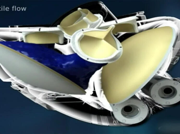 Coeur Carmat : le point sur cette technologie | INA