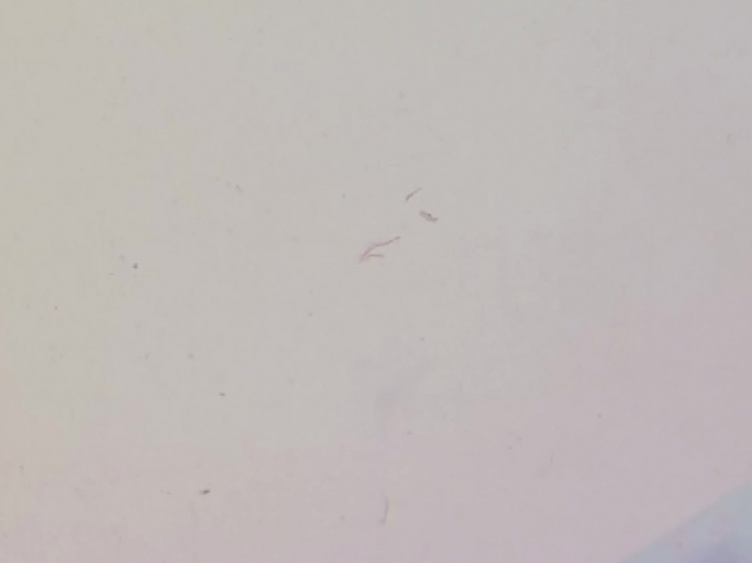 Commémoration du 11 novembre au mémorial de Vimy | INA