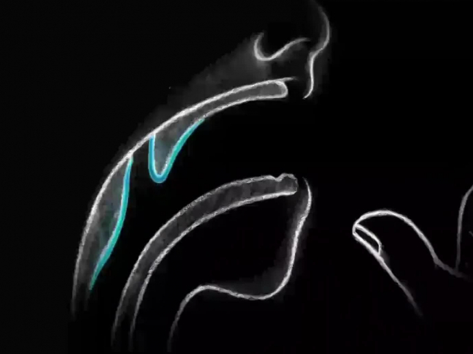 Douce nuit : Stop aux ronflements | INA