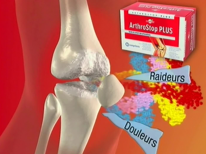 Arthrostop plus | INA